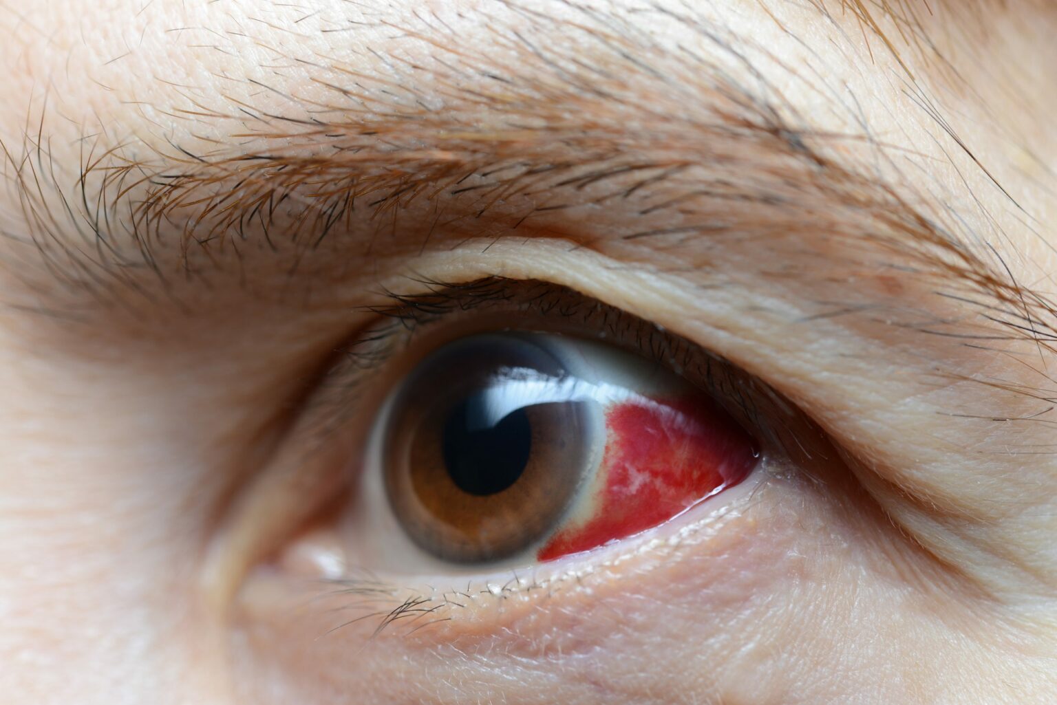 7 Common Eye Injuries | CityHealth