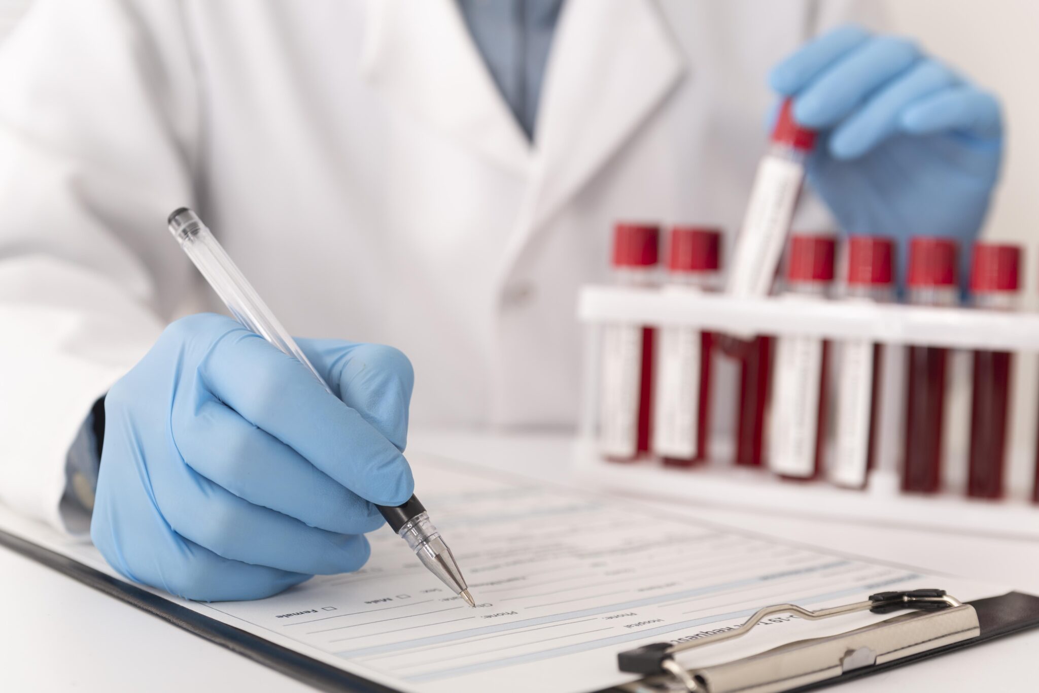 TB Test Near Me | Free TB Test with Insurance | CityHealth San Leandro